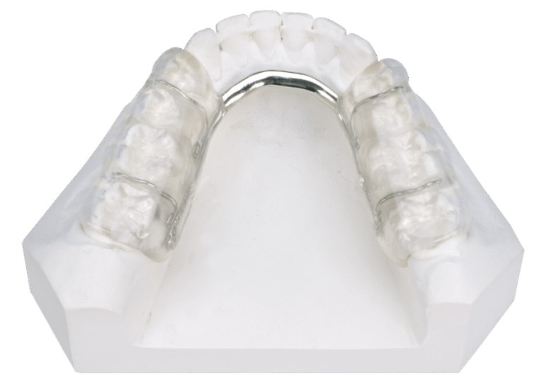 Okklusionsschienen | permadental